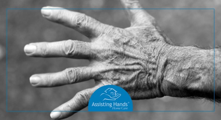 What Causes Bleeding Under the Skin in Seniors?